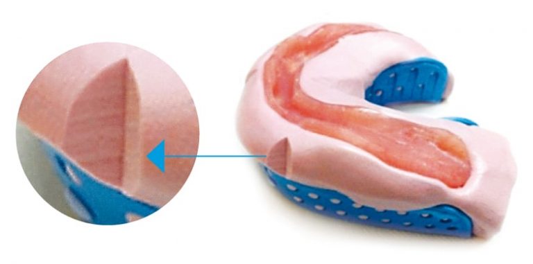 Copy Technique for Complete Dentures | MediMatch Dental Laboratory