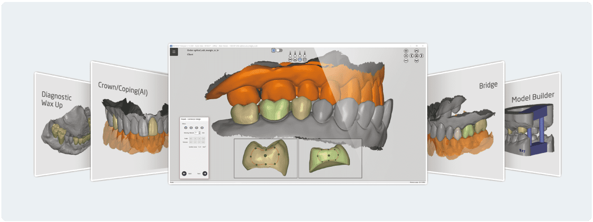 RAYiOS | MediMatch Dental Laboratory