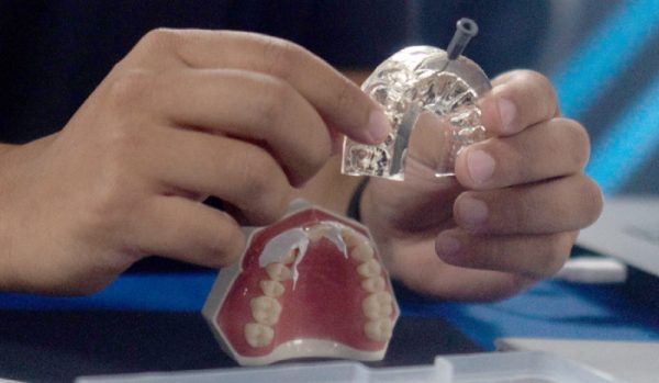 Composite Veneers Course | MediMatch Dental Laboratory Composite Veneers Course | MediMatch Dental Laboratory