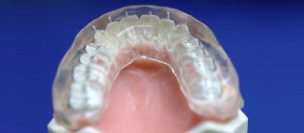 Composite Veneers Course | MediMatch Dental Laboratory Composite Veneers Course | MediMatch Dental Laboratory